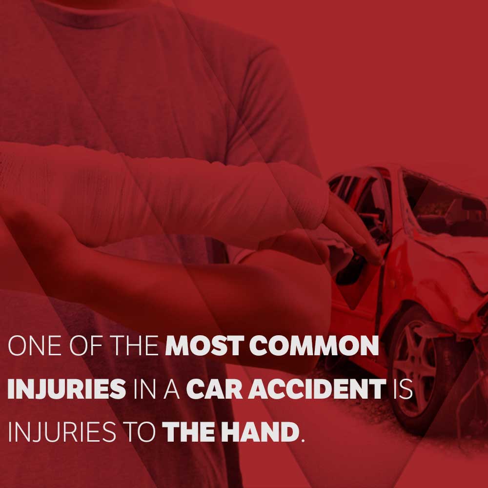 Broken Hand Car Accident Settlement