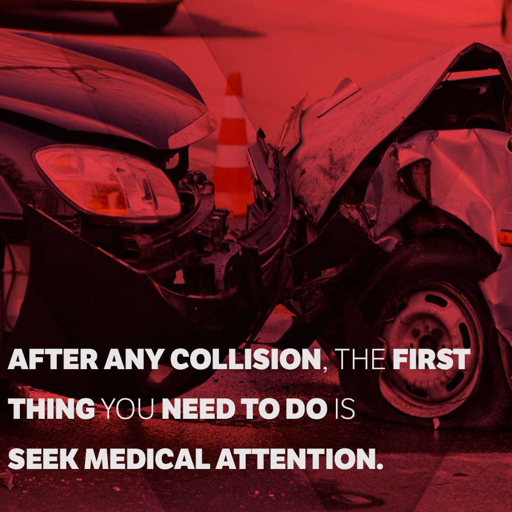 Common Head On Collision Injuries