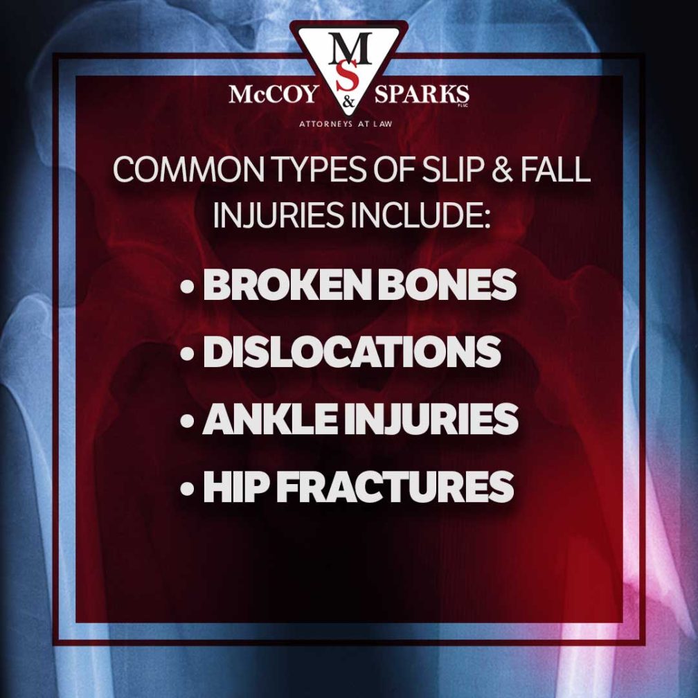 Slip and Fall Lawyer | Free consultation